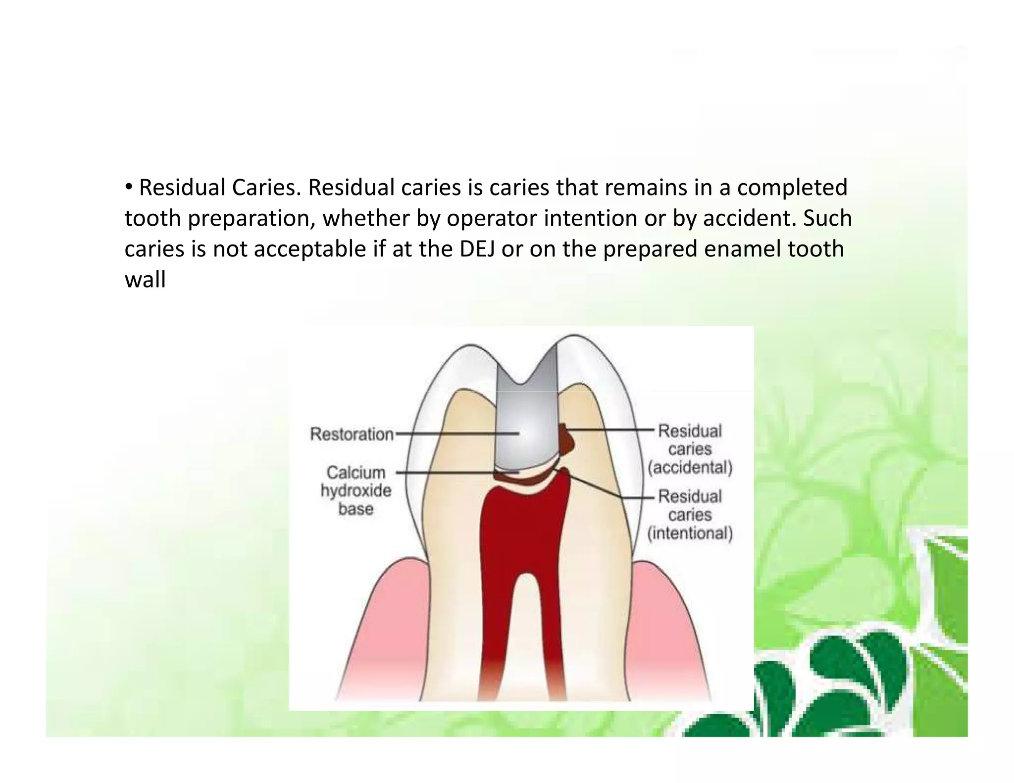 Principles of tooth preparation | PPT