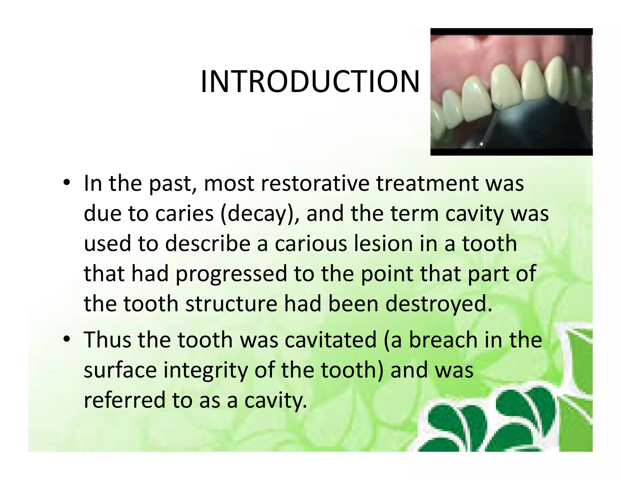 Principles of tooth preparation | PPT