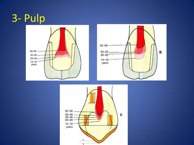 Principles of tooth preparation fixed orthodontic | PPTX | Dental ...