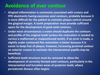 Principles of tooth preparation fixed orthodontic | PPTX