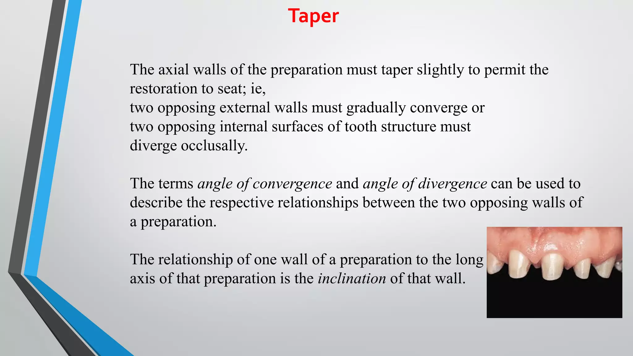 Principles of tooth preparation | PDF