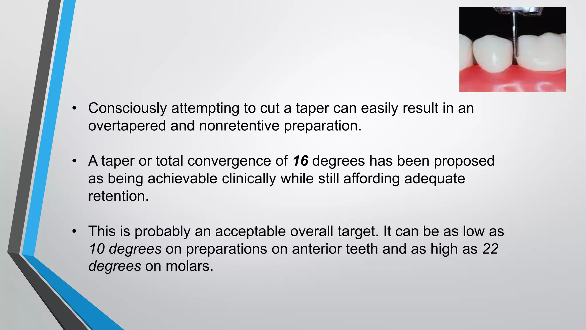 Principles of tooth preparation | PDF