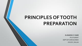Principles of tooth preparation | PDF