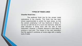 Principles of tooth preparation | PDF