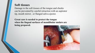 Principles of tooth preparation | PDF