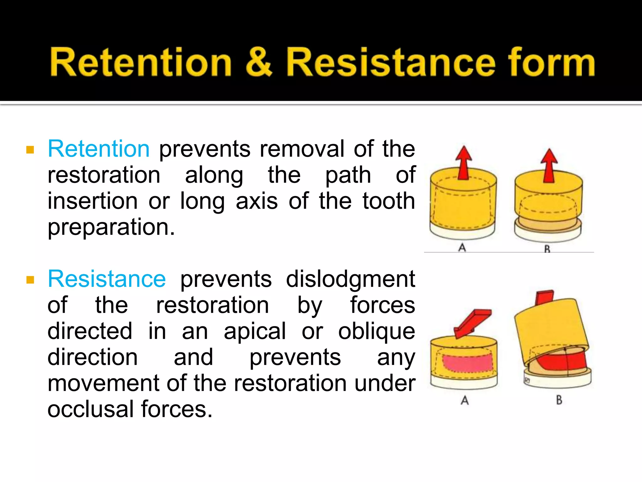 Principles of tooth preparation in Fixed Partial Dentures | PPTX
