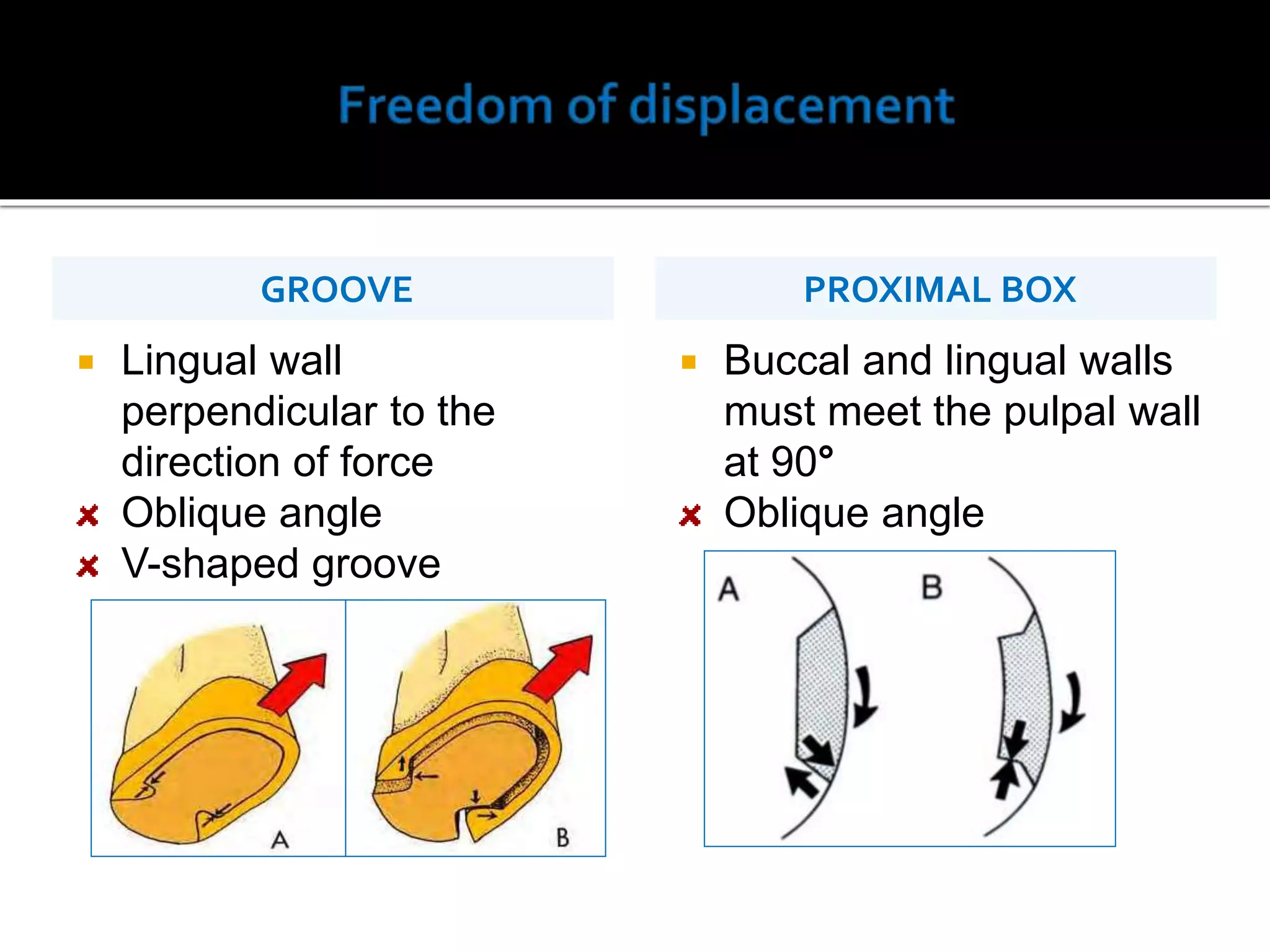 Principles of tooth preparation in Fixed Partial Dentures | PPTX