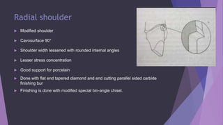 Principles of tooth preparation | PPTX