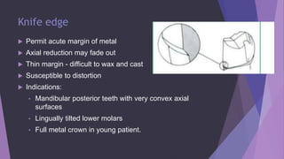 Principles of tooth preparation | PPTX