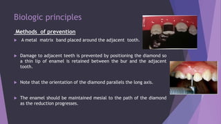 Principles of tooth preparation | PPTX
