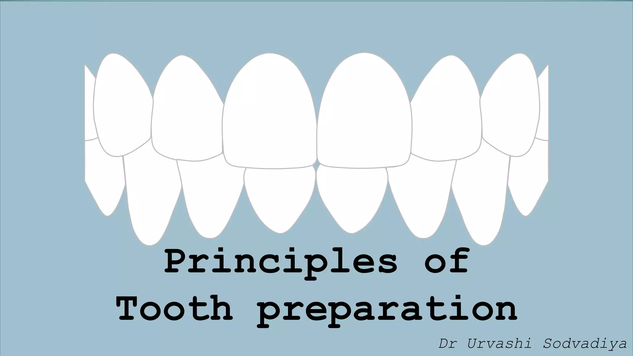 Principles of tooth preparation | PPTX