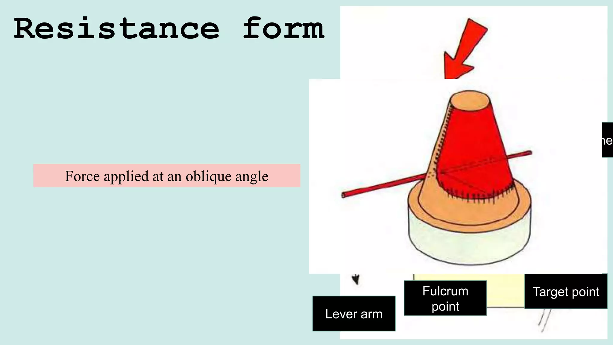 Principles of tooth preparation | PPTX