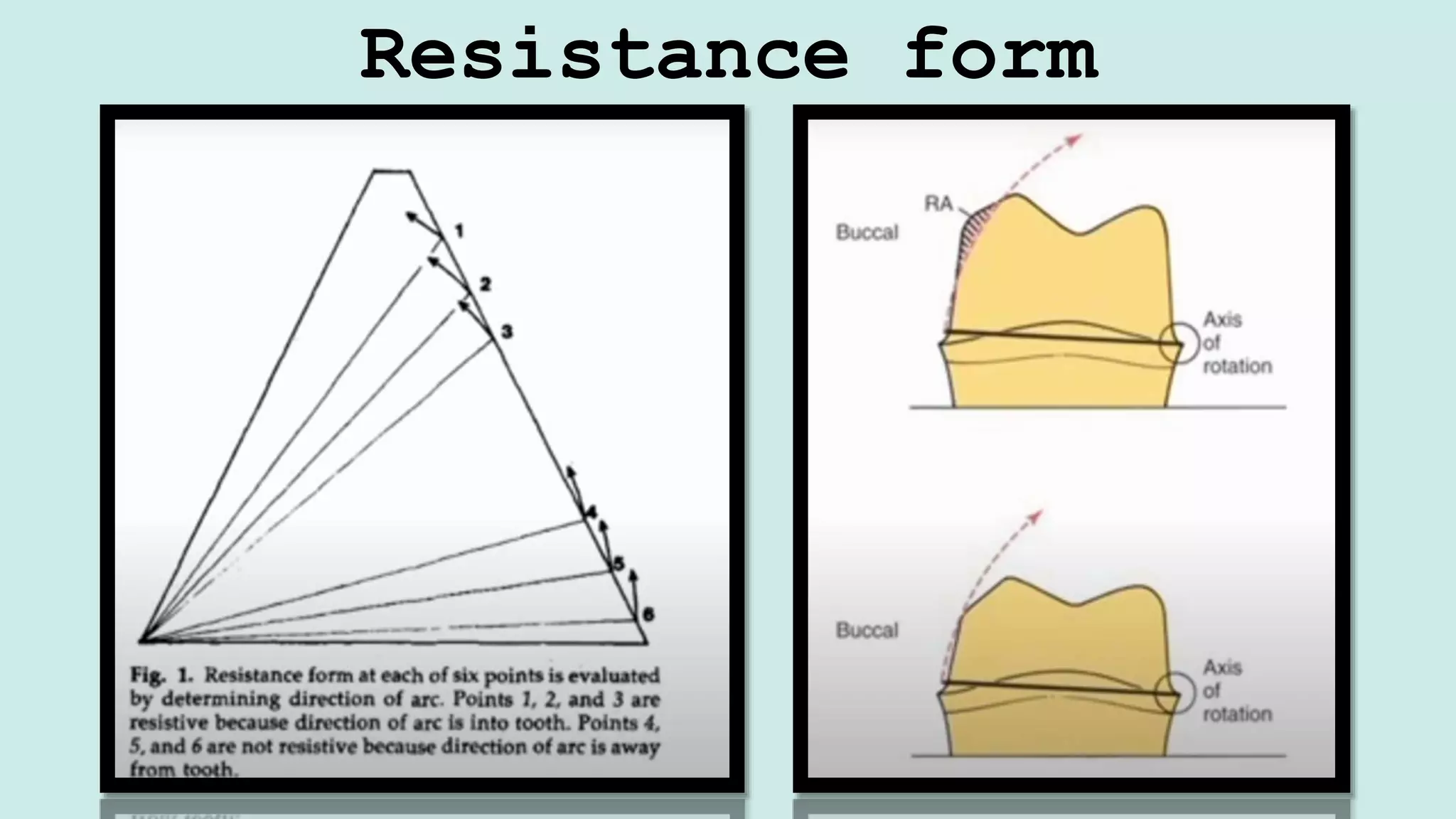Principles of tooth preparation | PPTX