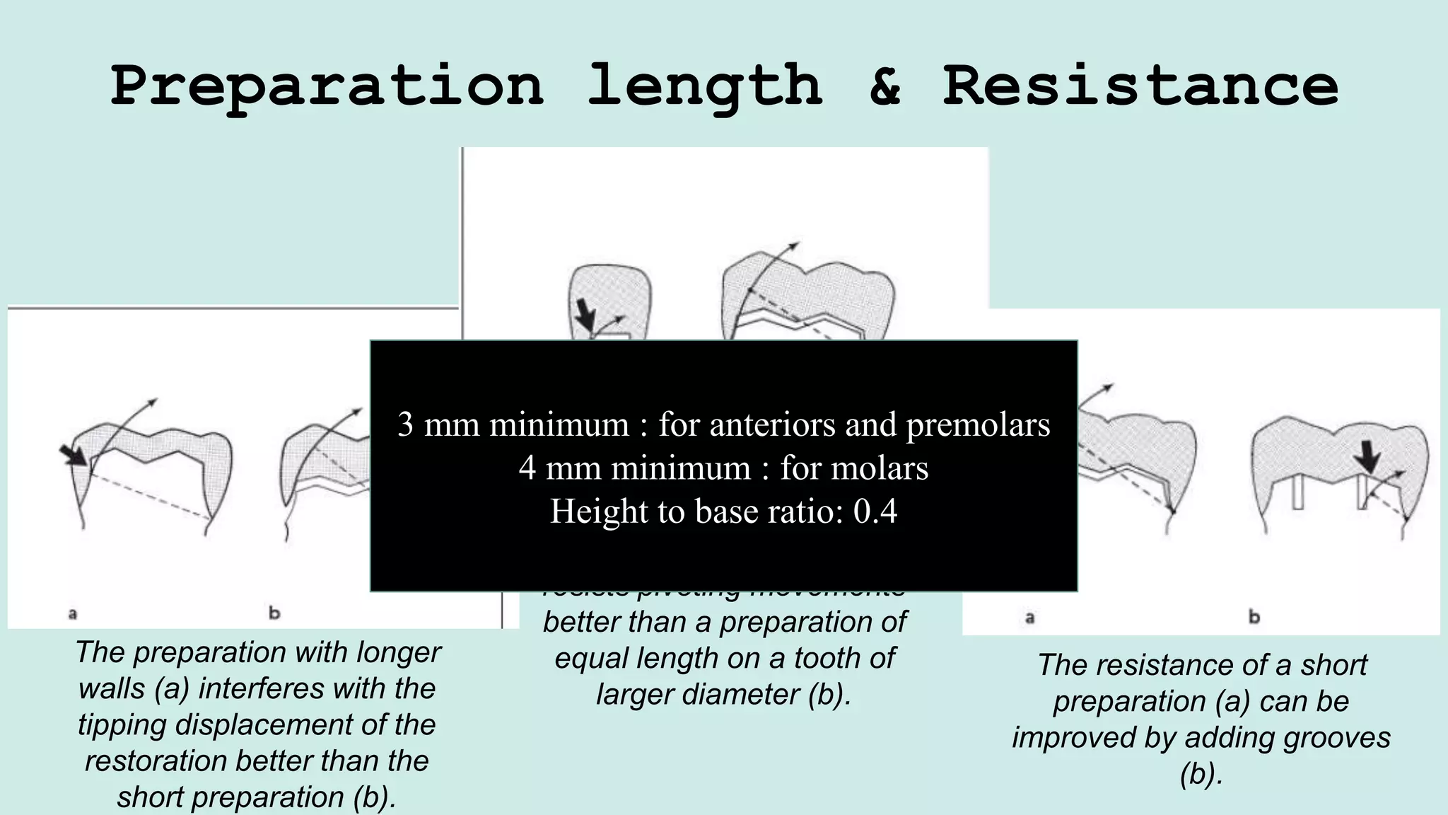 Principles of tooth preparation | PPTX