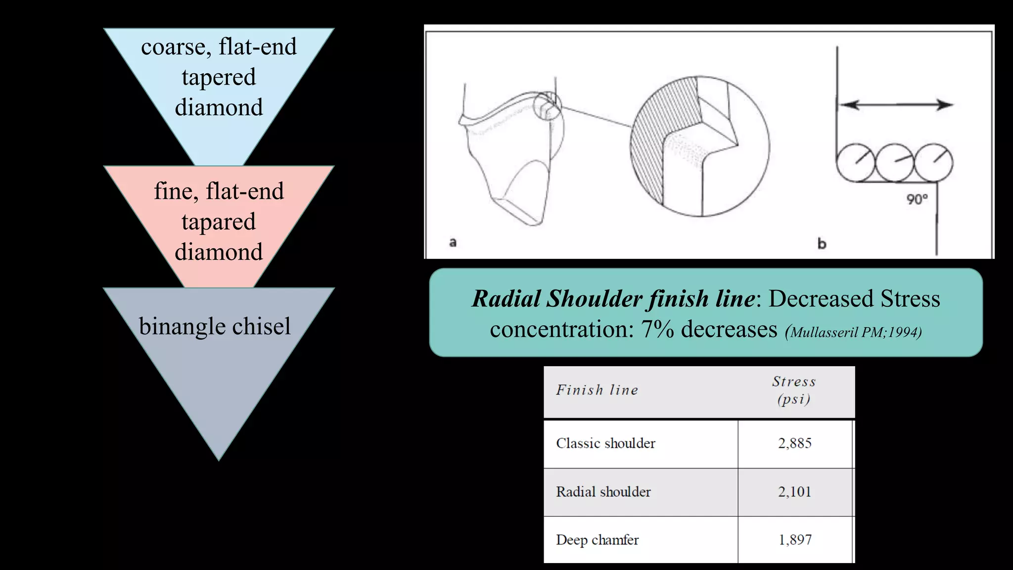 Principles of tooth preparation | PPTX