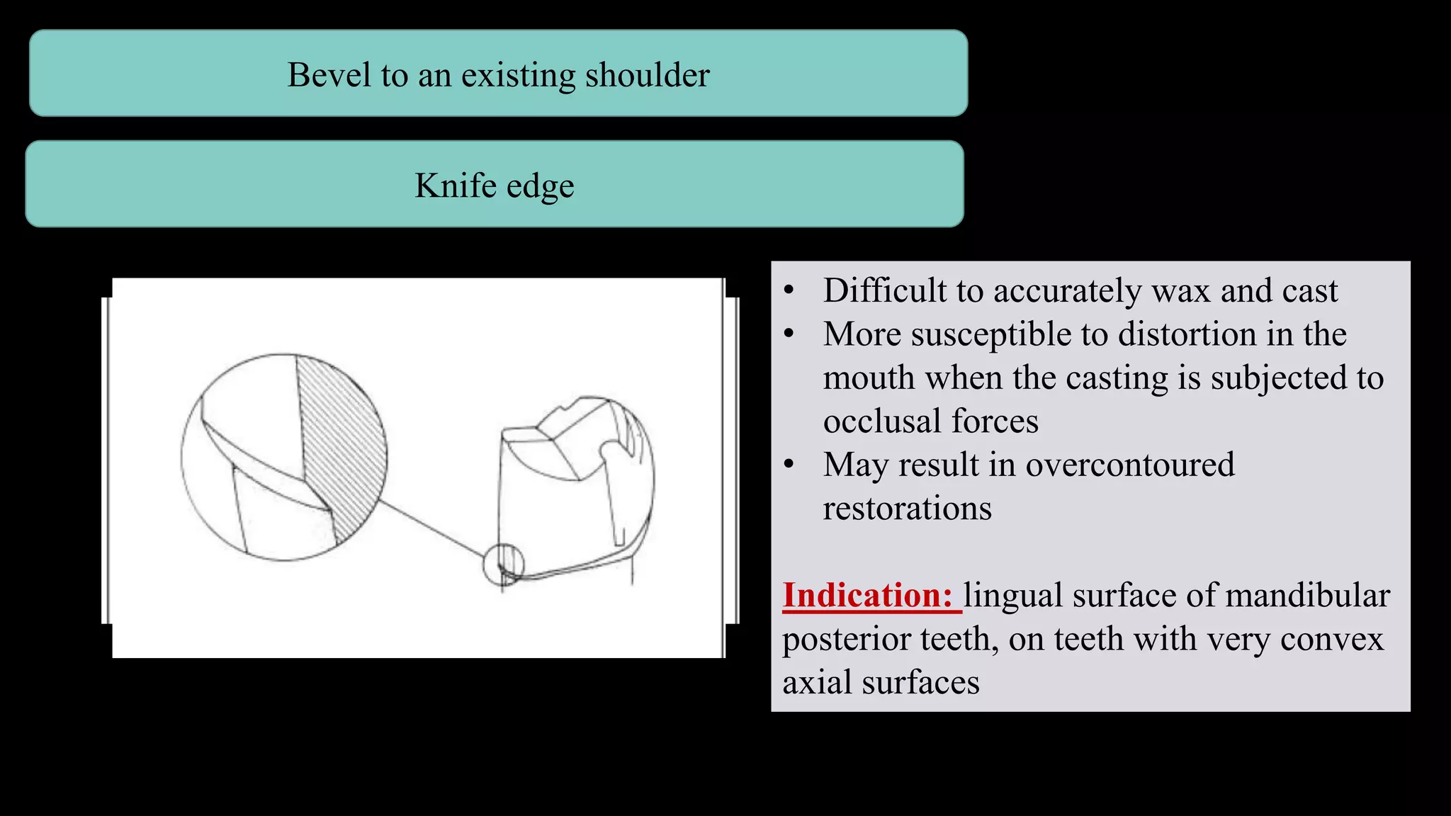 Principles of tooth preparation | PPTX