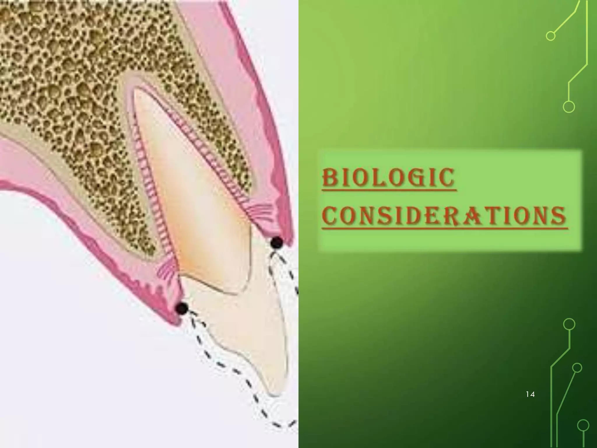Principles of tooth preparation | PPTX