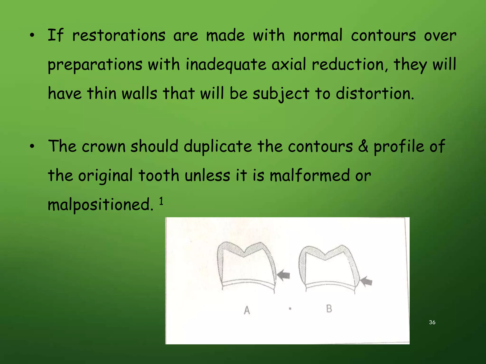 Principles of tooth preparation | PPTX