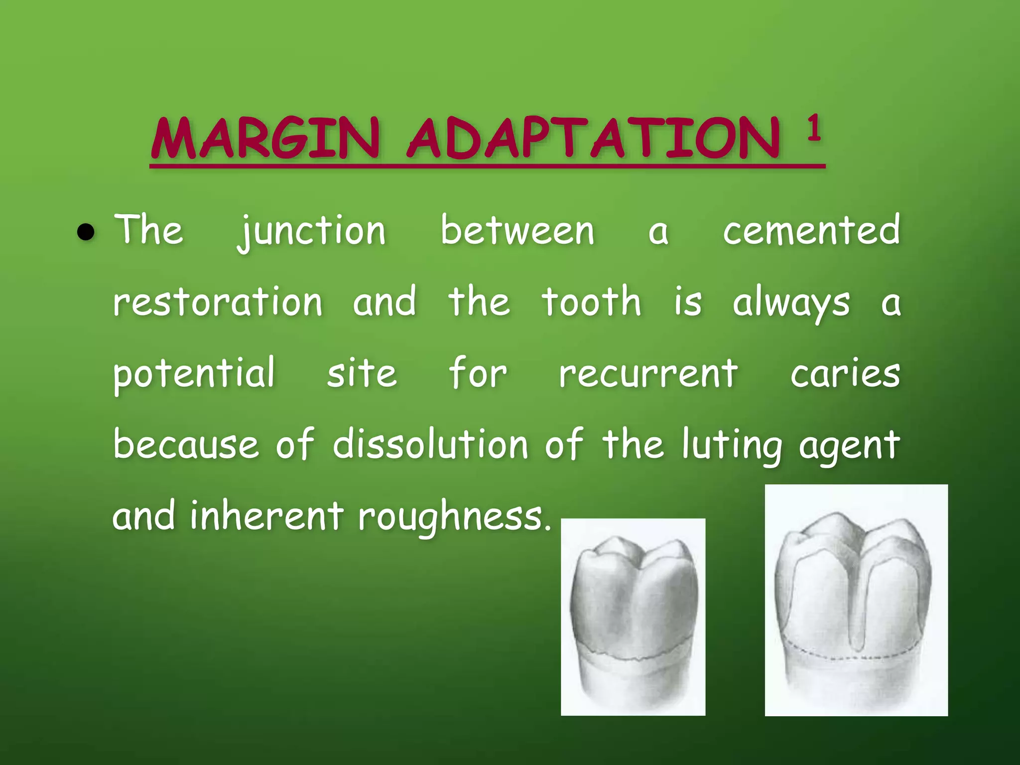 Principles of tooth preparation | PPTX