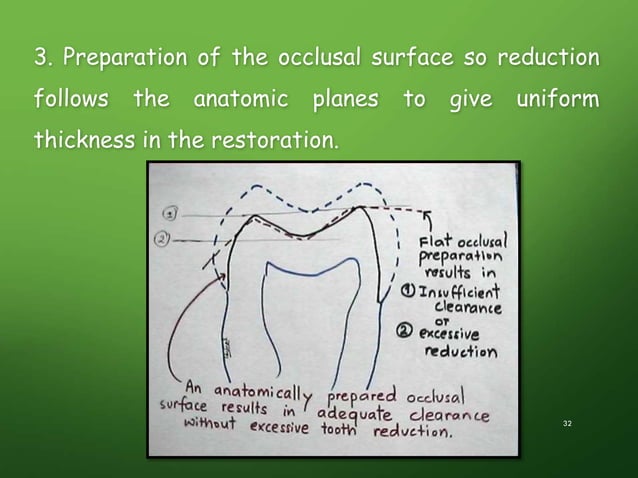 Principles of tooth preparation | PPTX | Dental Health | Diseases and Conditions