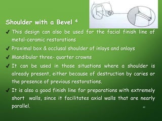 Principles of tooth preparation | PPTX