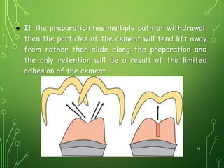 Principles of tooth preparation | PPTX