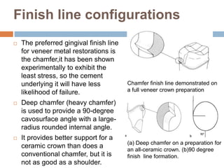 Principles of tooth preparation | PPTX