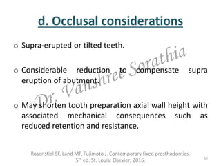 Principles of Tooth Preparation | PPTX