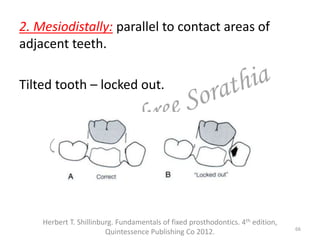 Principles of Tooth Preparation | PPTX