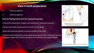 Principles of tooth preparation | PPTX