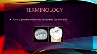 Principles of tooth preparation | PPTX