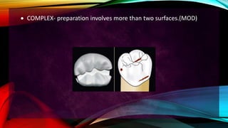 Principles of tooth preparation | PPTX