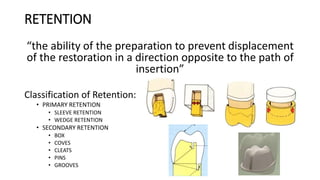 PRINCIPLES OF TOOTH PREPARATION.pptx