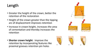PRINCIPLES OF TOOTH PREPARATION.pptx