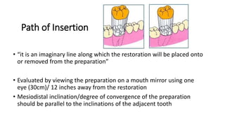 PRINCIPLES OF TOOTH PREPARATION.pptx