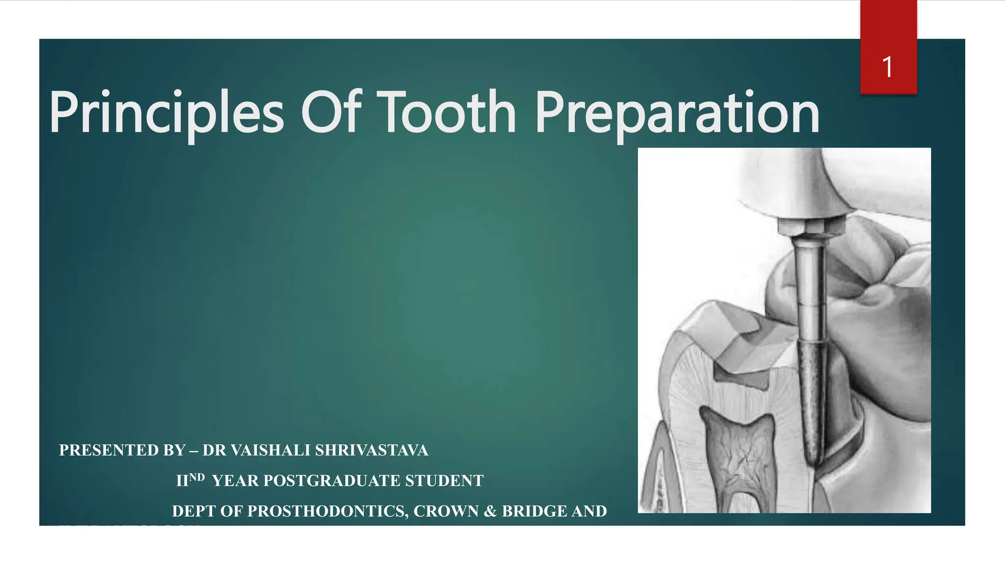 Principles Of Tooth Preparation.pptx