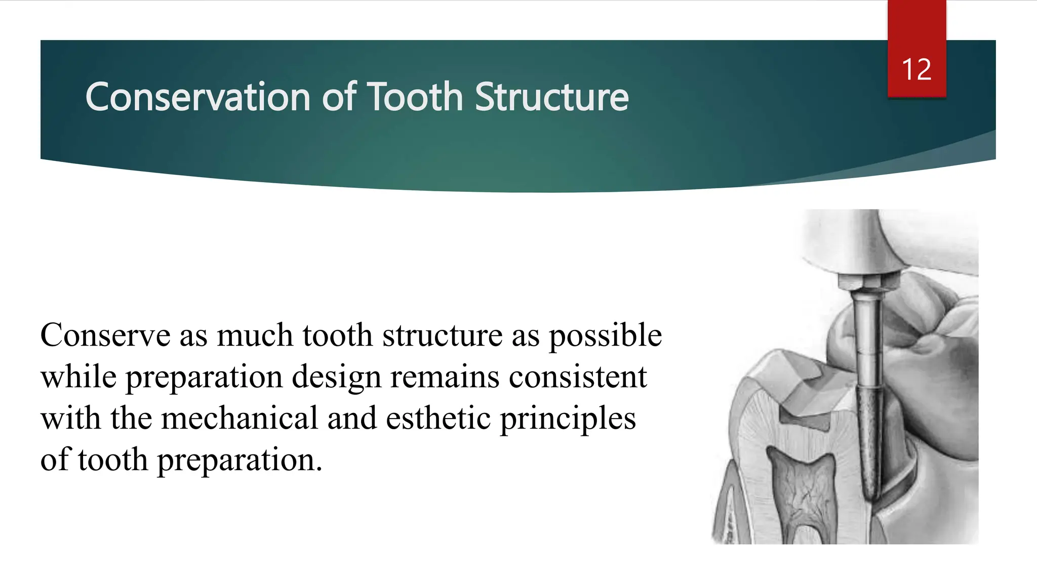 Principles Of Tooth Preparation.pptx