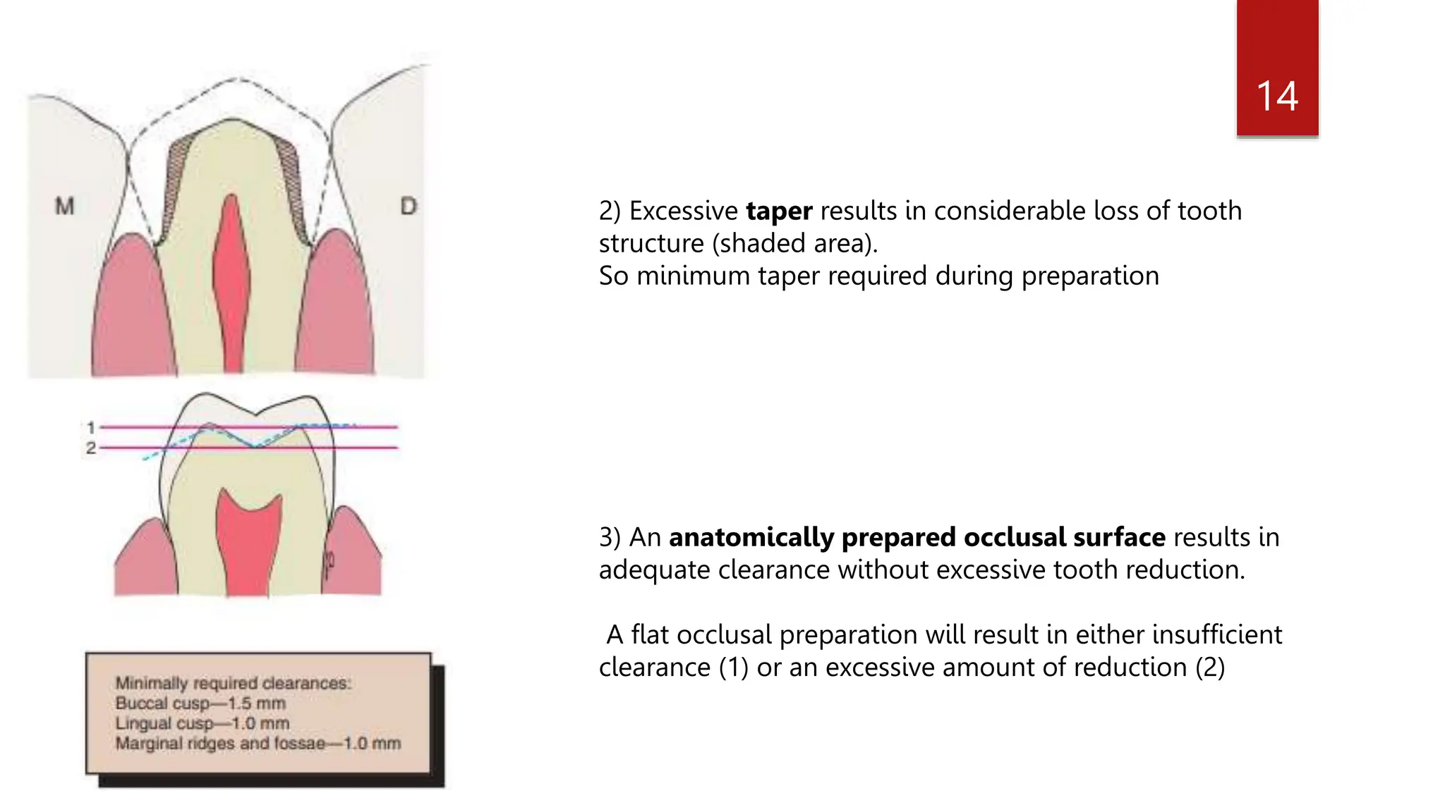 Principles Of Tooth Preparation.pptx