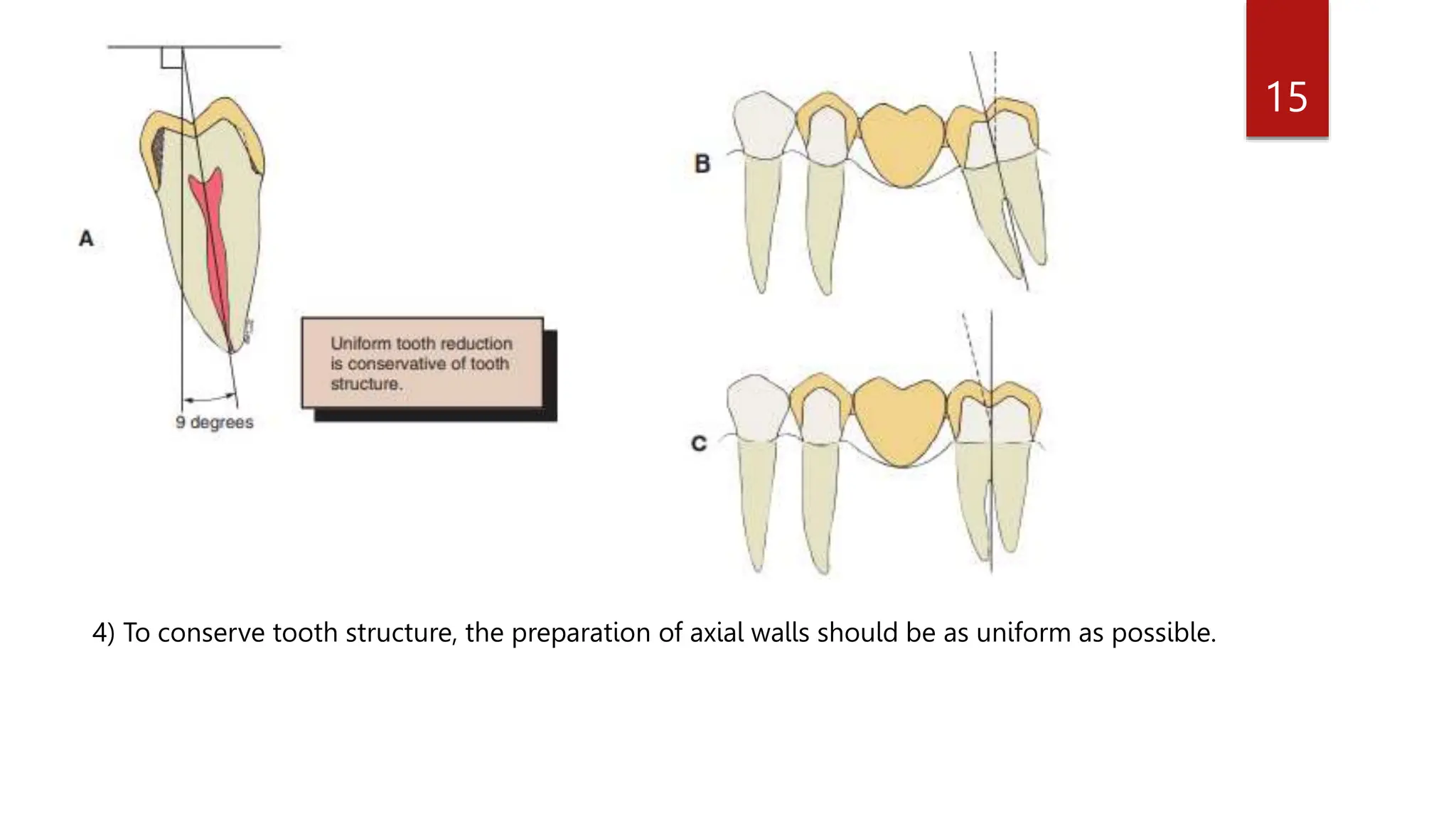 Principles Of Tooth Preparation.pptx