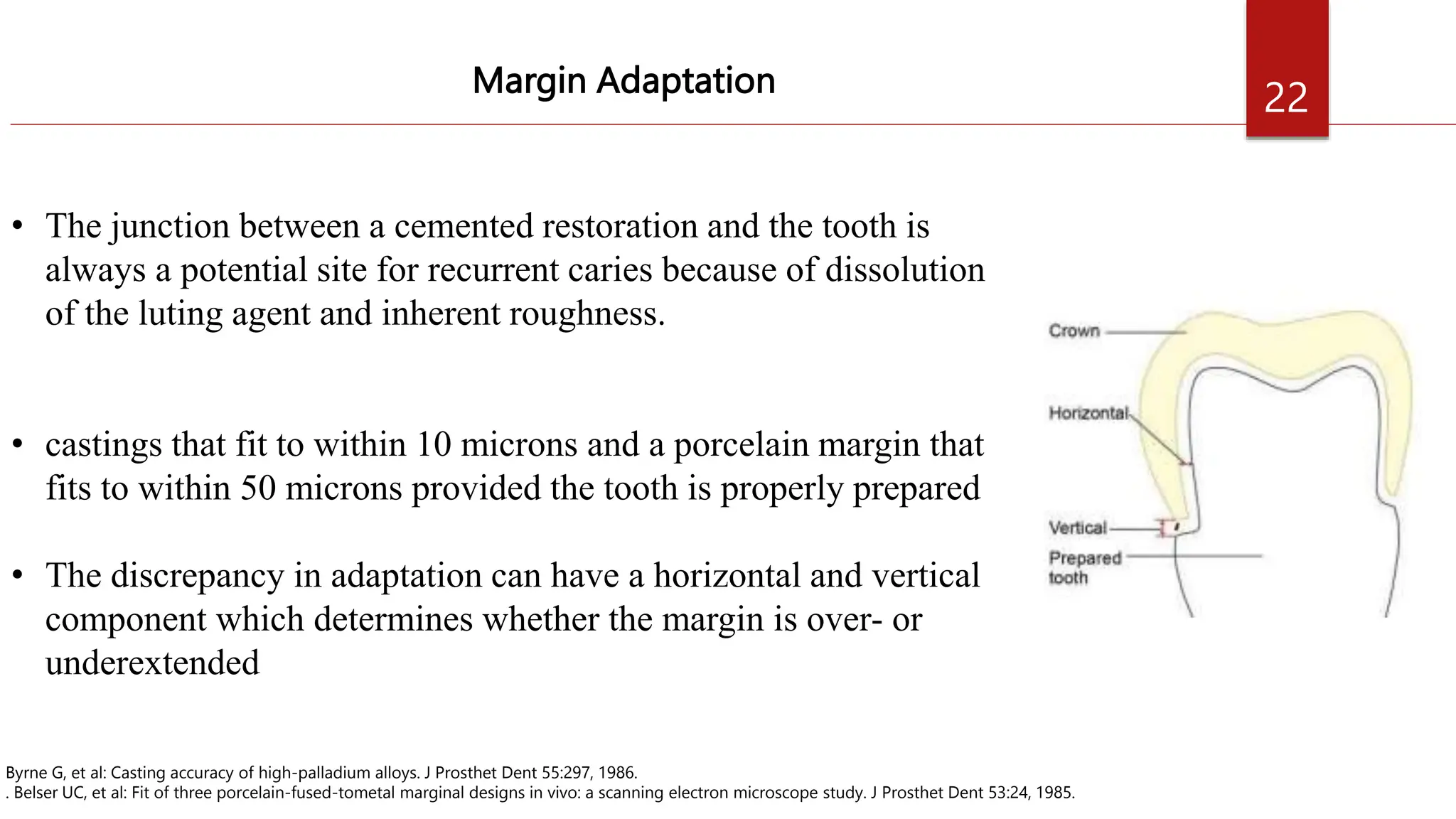 Principles Of Tooth Preparation.pptx