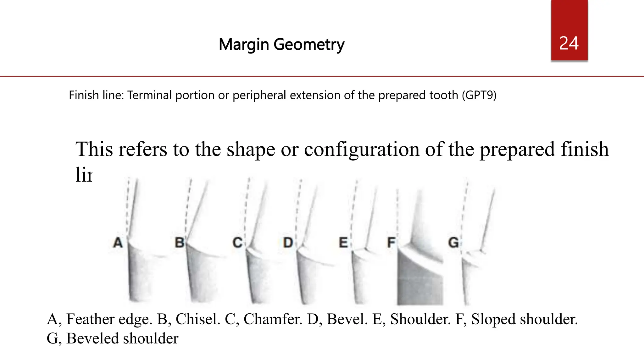 Principles Of Tooth Preparation.pptx