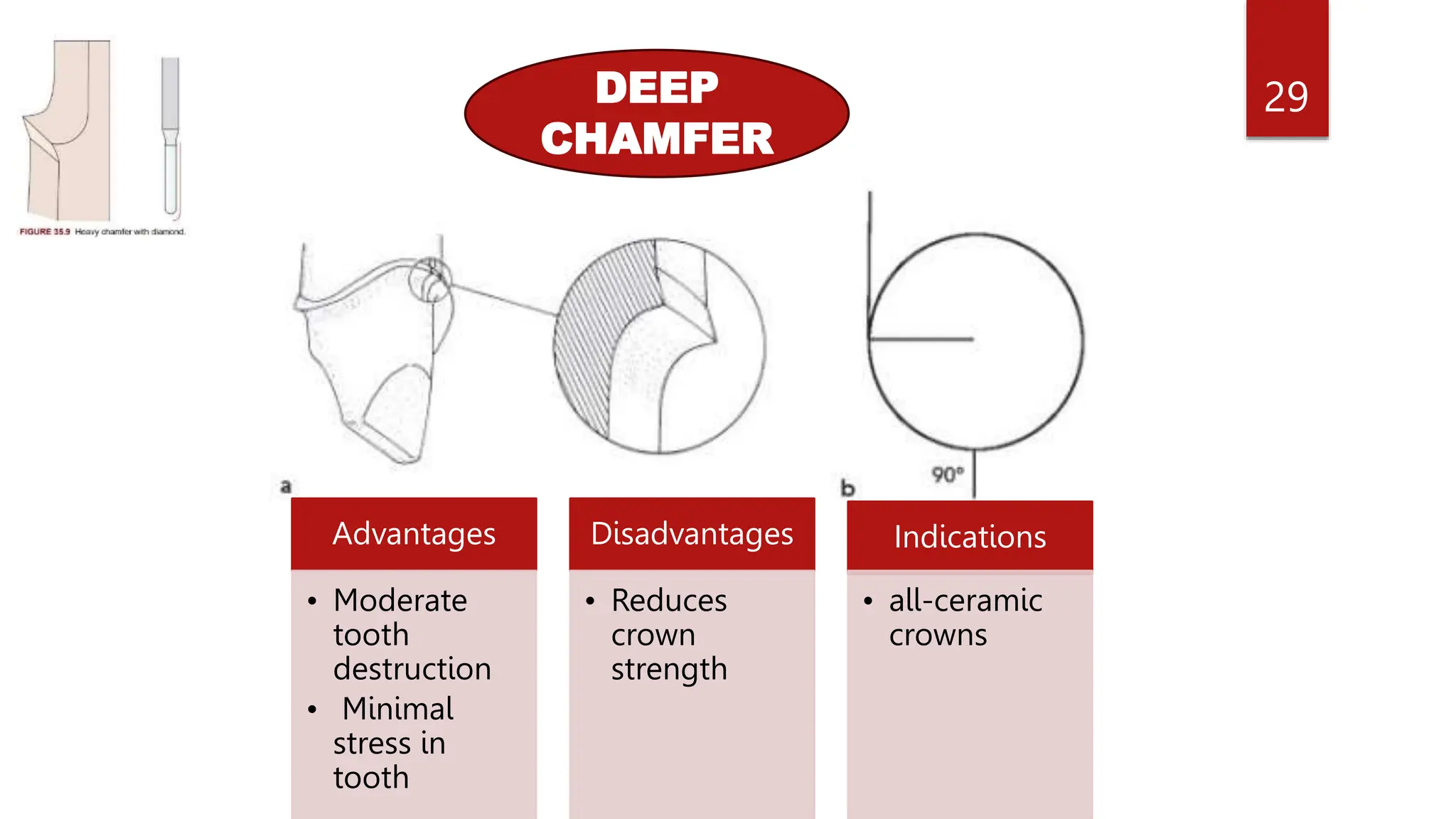 Principles Of Tooth Preparation.pptx