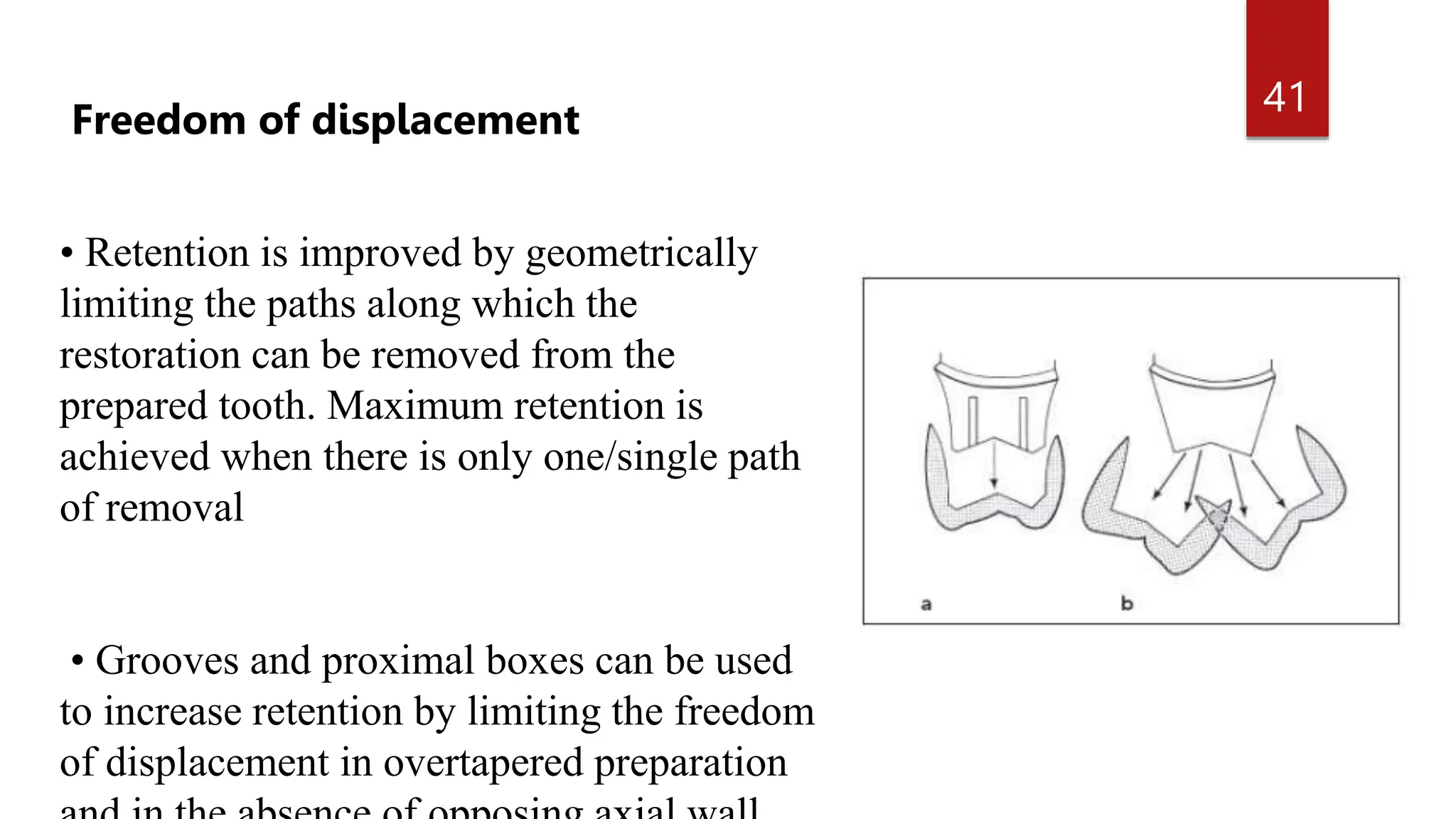 Principles Of Tooth Preparation.pptx