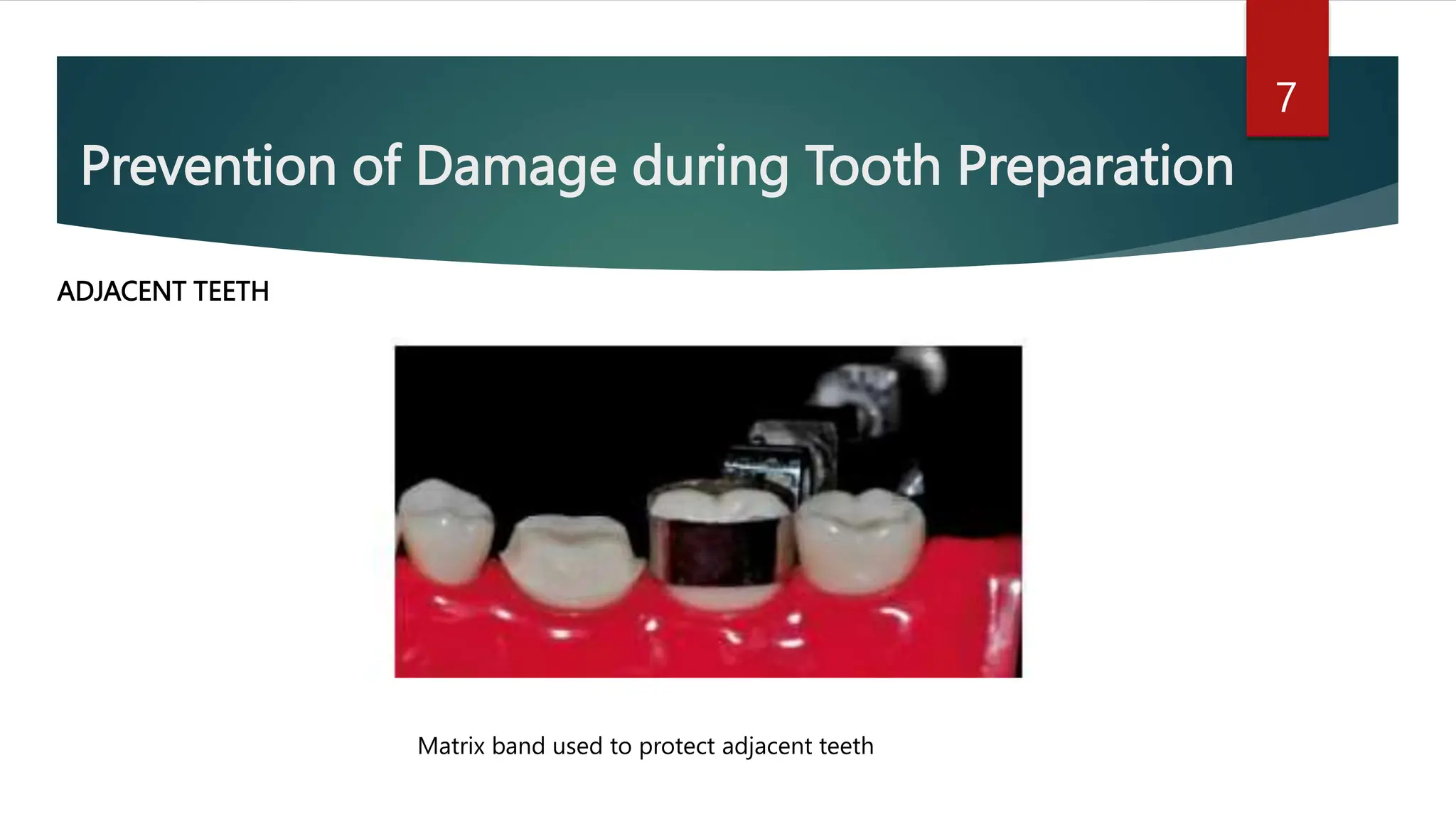 Principles Of Tooth Preparation.pptx