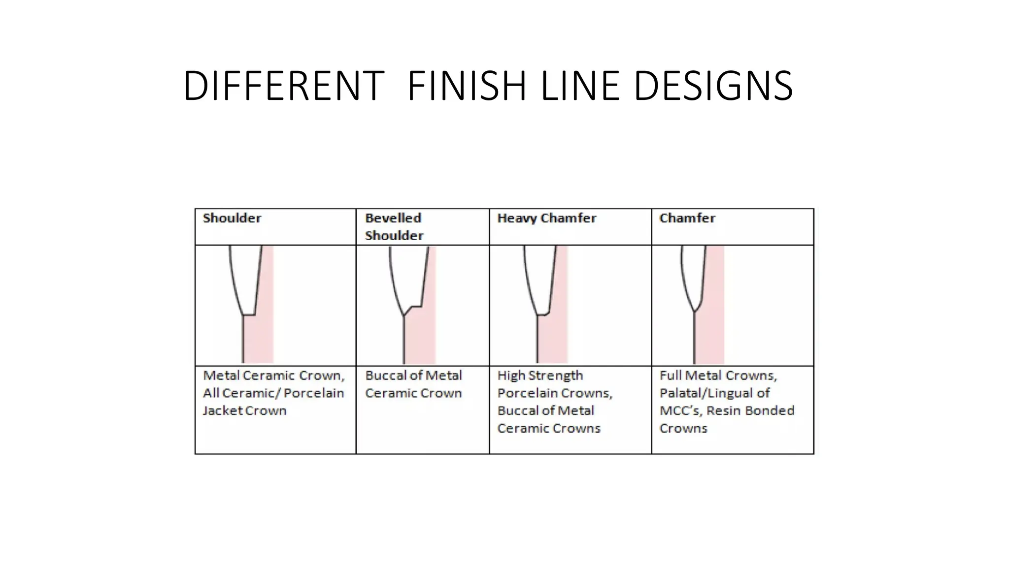 PRINCIPLES OF TOOTH PREPARATION for fixed Prosthodontics.pptx