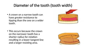 PRINCIPLES OF TOOTH PREPARATION for fixed Prosthodontics.pptx