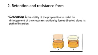 PRINCIPLES OF TOOTH PREPARATION for fixed Prosthodontics.pptx