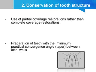 principles of tooth preparation - ann george final.pptx