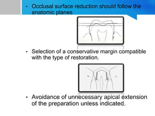 principles of tooth preparation - ann george final.pptx