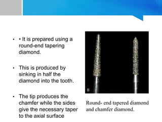 principles of tooth preparation - ann george final.pptx